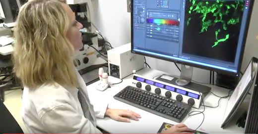 Invasive lung cancer cells have distinct roles